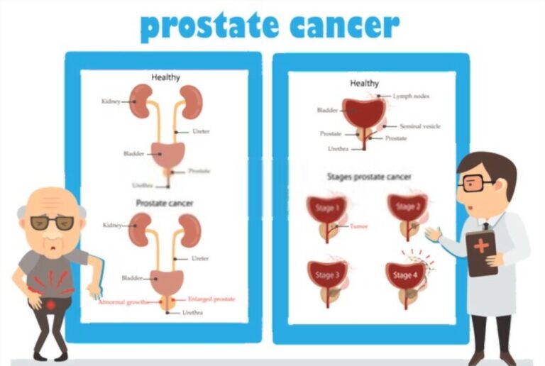 10 Warning Signs of Testicular Cancer – Kmh Health blog
